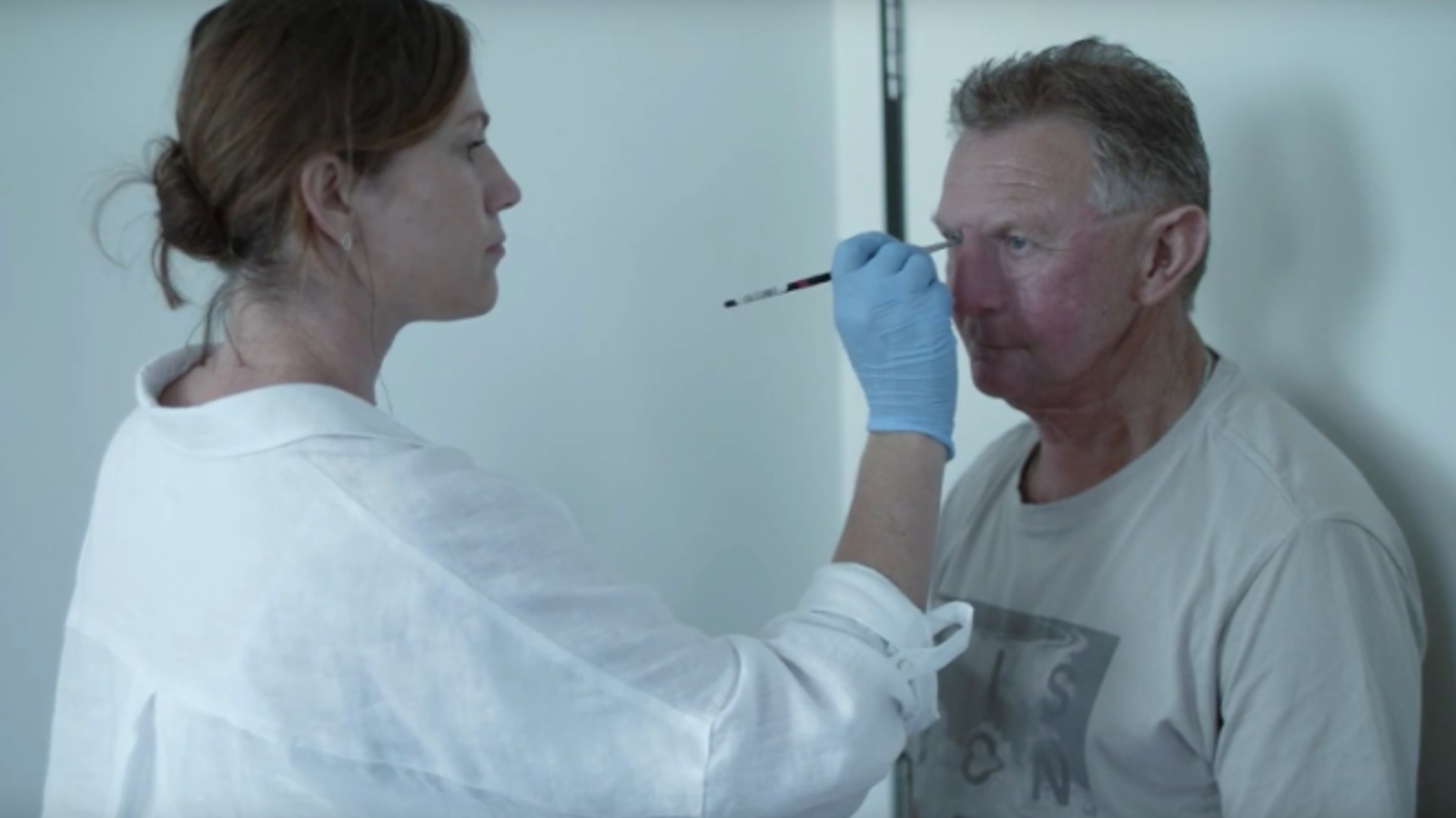 Prosthetic Art Technology | Head and Neck Cancer Australia