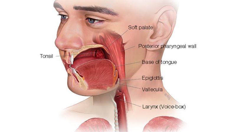 Salivary Gland Cancer Head And Neck Cancer Australia