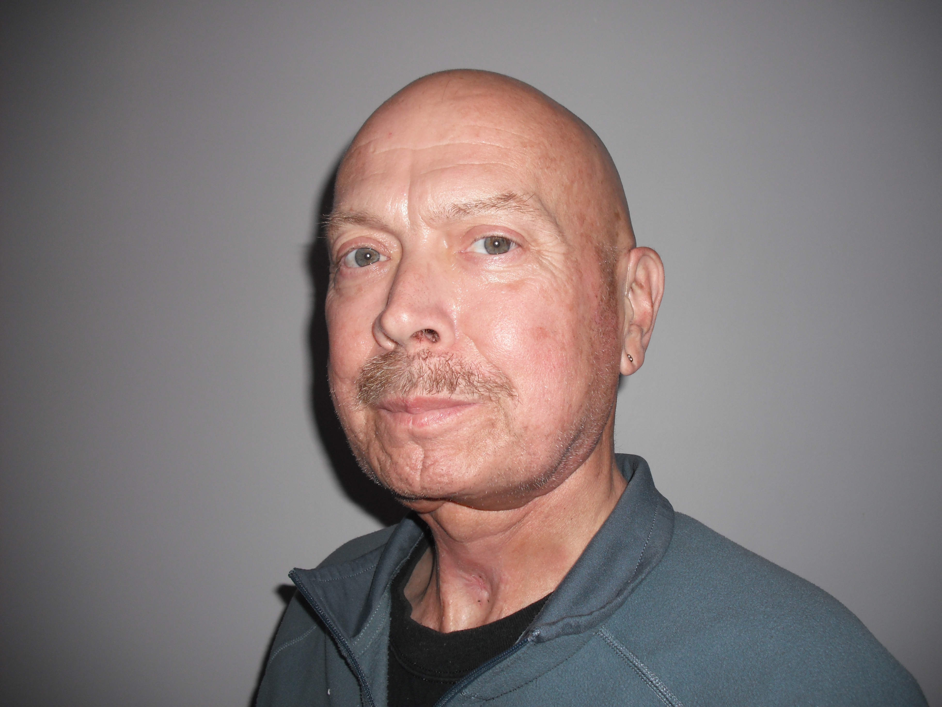 Stephen Mcpherson｜Head and Neck Cancer Australia