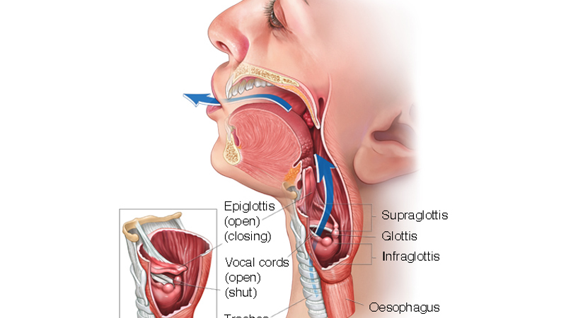 Laryngeal Cancer - Head and Neck Cancer Australia