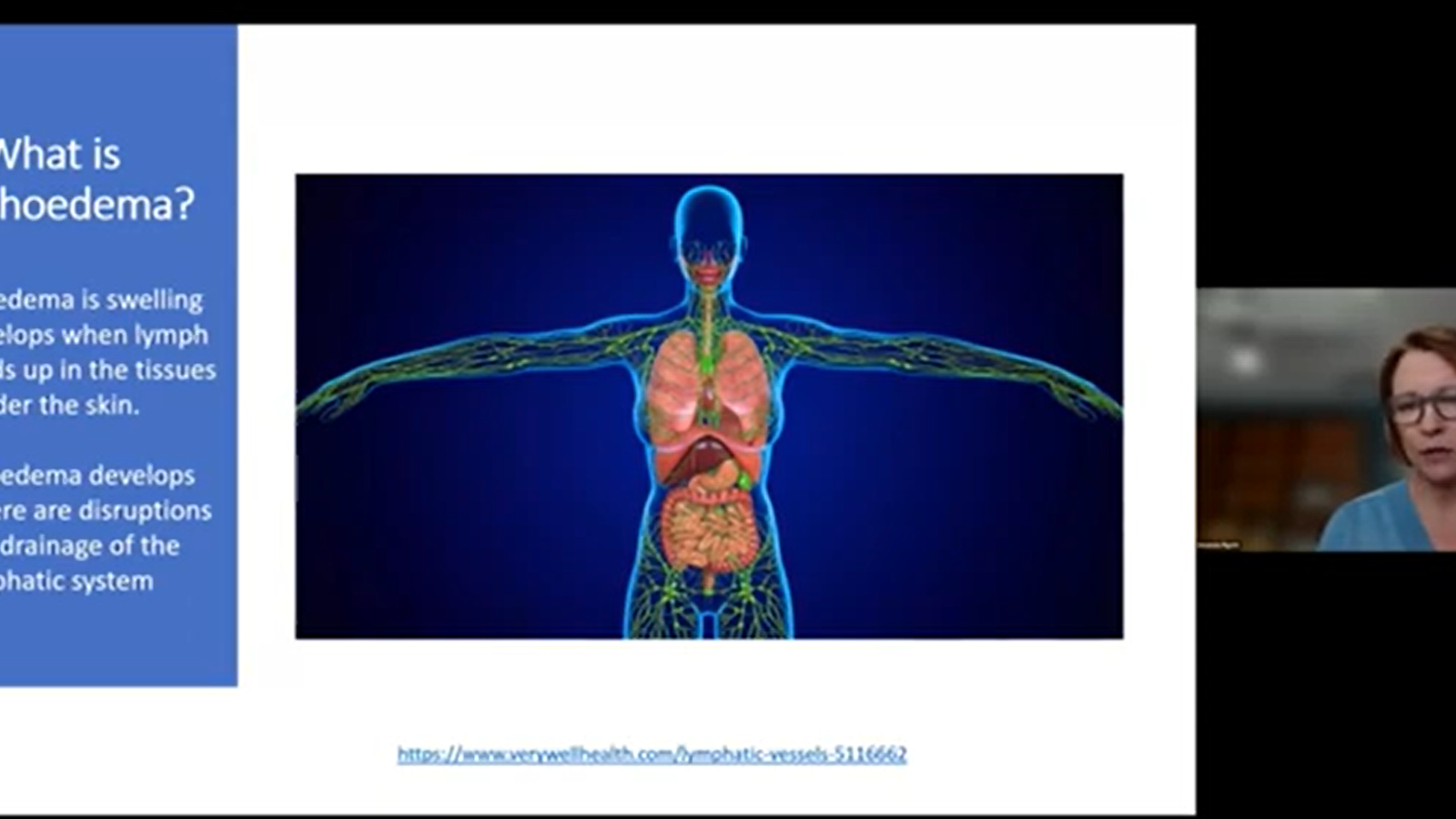 Webinar: Lymphoedema after Head and Neck Cancer Treatment | Head and ...